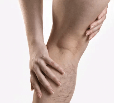 Vein Centers of California | San Diego Location